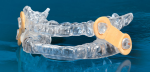 Sleep Apnea and Snoring Spring Lake Monmouth County New Jersey NJ