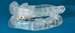 Sleep Apnea and Snoring Spring Lake Monmouth County New Jersey NJ